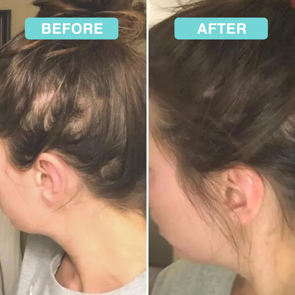 Capilair™ - Scalp Massager – Monova.ma